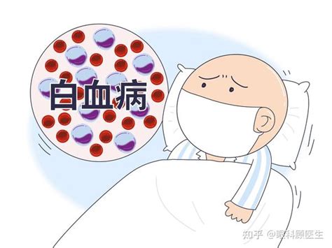 白血病也可能会失明 知乎