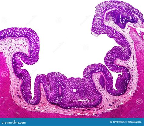 Histology Of Human Appendix Micrograph Showing Crypts Of Lieberkuhn Stock Image Image Of