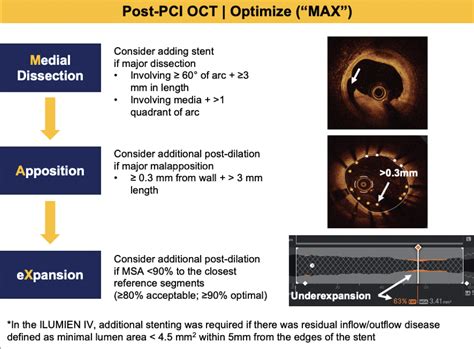 Oct Guided Pci Lessons From The Ilumien Iv Optimal Pci Trial