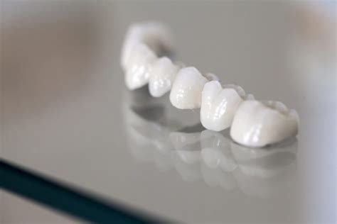 Vrste I Cene Krunica Za Zube Mnd Dental