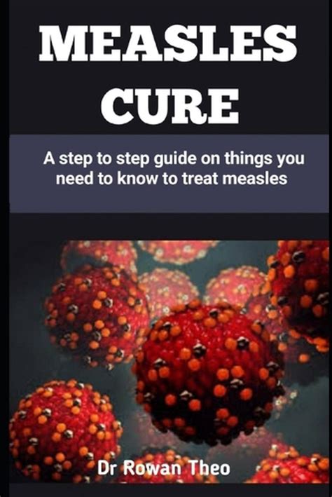 Measles Cure A Step To Step Guide On Things You Need To Know To Treat