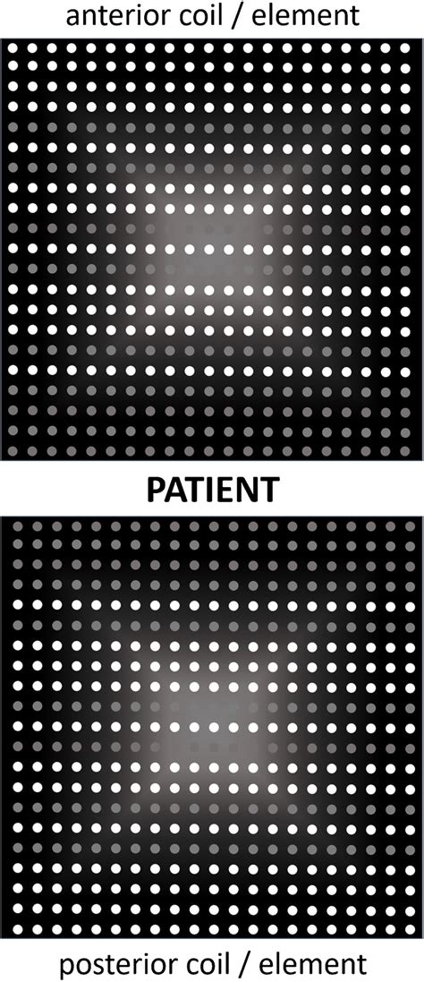 Compressed Sensing K Space Combined With Parallel Imaging In This Download Scientific Diagram