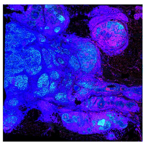 Visium Immunofluorescence Data • Semla