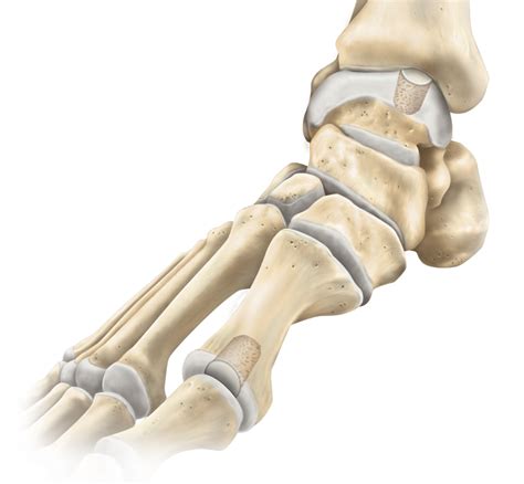 Arthrex Chondral Defect