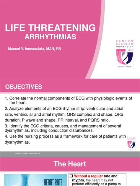 Ncm 118 Lecture Life Threatening Arrhythmias Mvimmaculata For Ceu