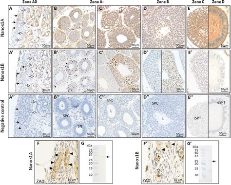 Different Subcellular Localizations Of Nanos1a And Nanos1b Proteins In Download Scientific