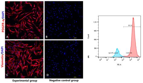Isolation Culture And Characterization Of Primary Dermal Fibroblasts From Human Keloid Tissue