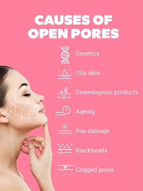 Open Pores Types Causes Symptoms And Treatment