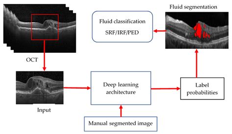 On Machine Learning In Clinical Interpretation Of Retinal Diseases Using Oct Images