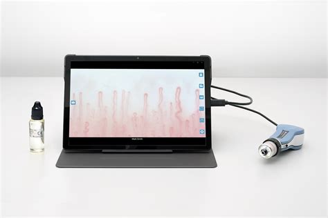 Digital Capillaroscopy Capillaroscopy