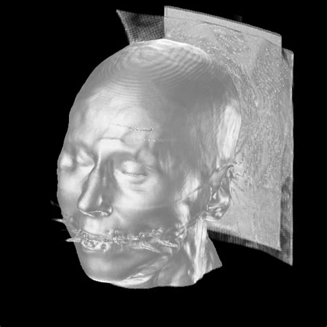A Volume Rendering Of A Face With Voxel Projection 0 95 Sec Download Scientific Diagram