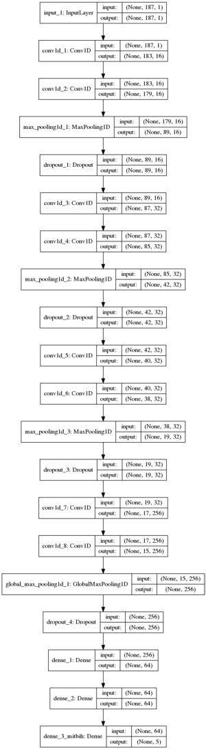Heartbeat Classification Detecting Abnormal Heartbeats And Heart