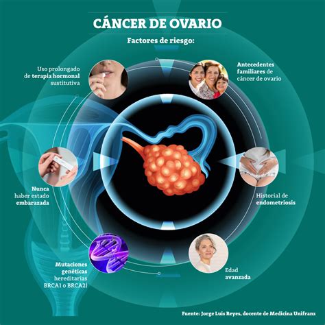 Cuidado Y Prevención Claves Para Reducir El Riesgo De Cáncer De Ovario