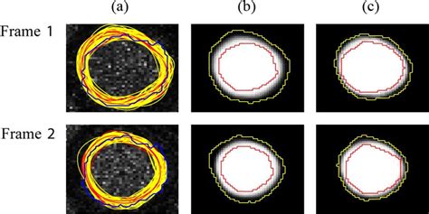 Lv Segmentation Results Yellow Of The Forward Backward Smoothing