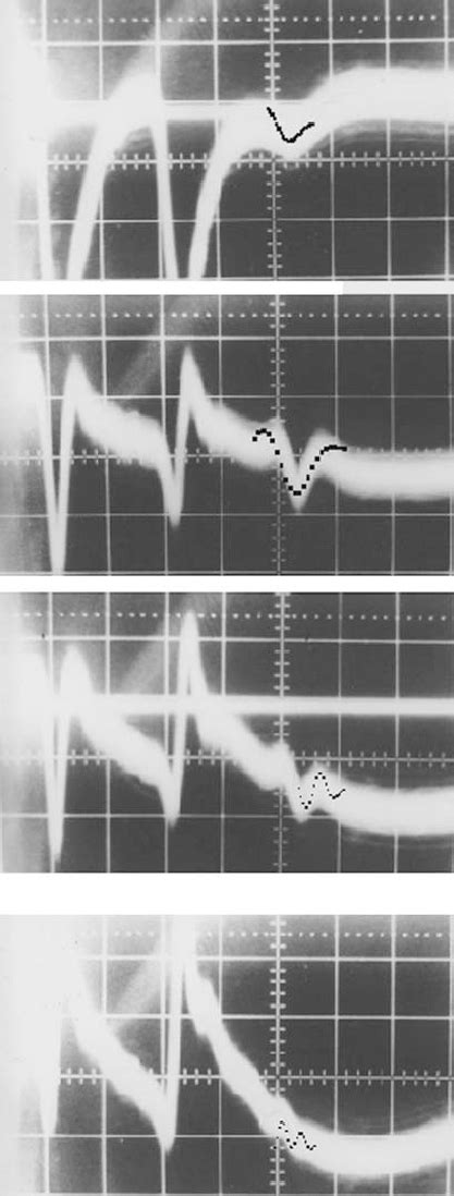 Suppression Of The Photon Echo Signals By An Intense Controlling Radiation Download
