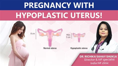 Pregnancy With Hypoplastic Uterus Small Uterus Dr Richika Sahay Shukla India Ivf Clinic