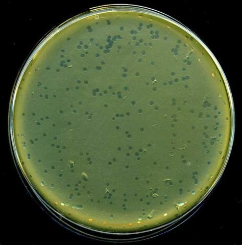 Phage Typing Alchetron The Free Social Encyclopedia