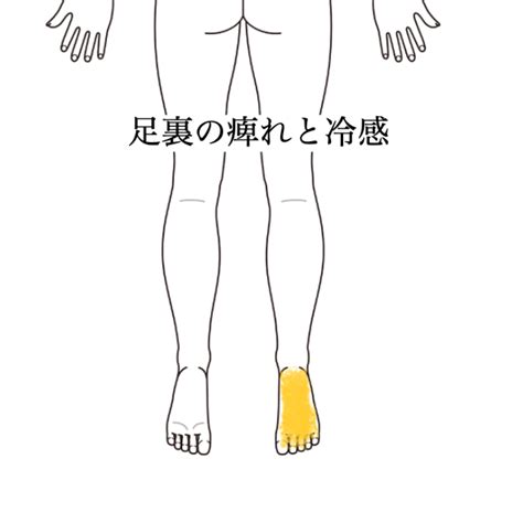 常にお尻から足までシビレて足がこわばる腰痛｜脚・足・足指のしびれ、腰痛のツボ｜ツボネット 鍼灸の症例が検索できるツボ辞典