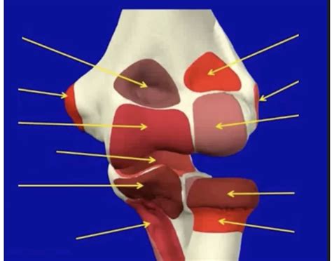 Humeral Ulnar Joint Bony Landmarks Quiz