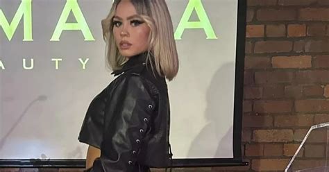 Model Famed For Lazy Eye Wows In All Leather Look Outfit In Sexy Post Op Snap Daily Star