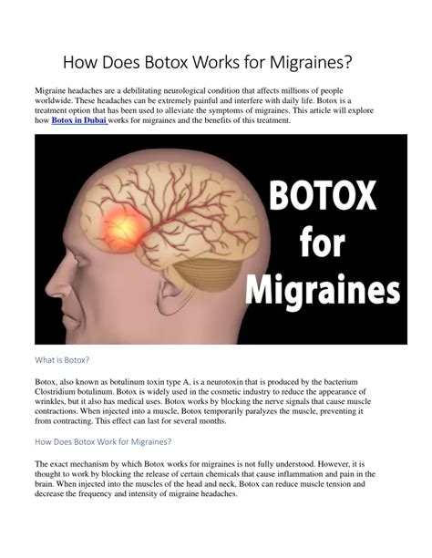 Ppt How Does Botox Works For Migraines Powerpoint Presentation Free Download Id 12021324