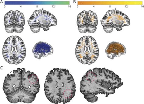 Neurology Volume 101 Number 1