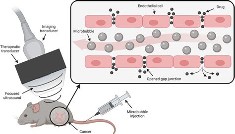 Image Guided Focused Ultrasound Fus And Microbubble Mb Interaction Download Scientific