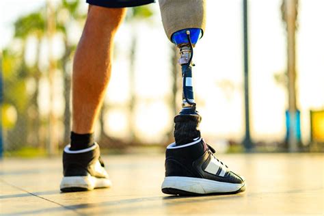 Everything You Need To Know About Below Knee Prosthetic Leg