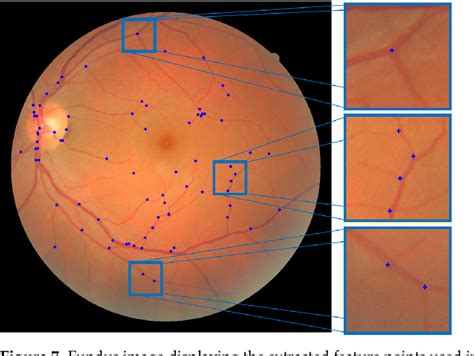 Figure 1 From A Straightforward Bifurcation Pattern Based Fundus Image