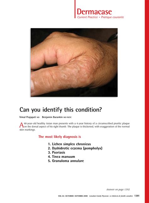 Pdf Dermacase Lichen Simplex Chronicus