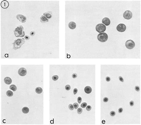 Light Micrographs Of Chick Erythroid Cells At Different Stages Of