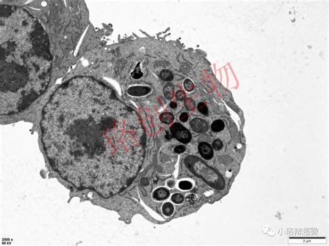 透射电镜下的细胞吞菌 海南省生物材料与医疗器械工程研究中心