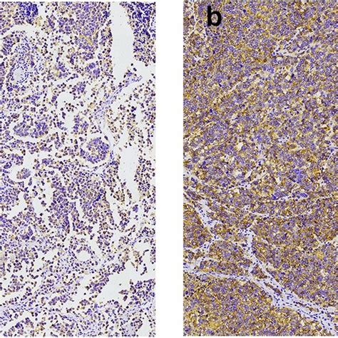 Mass In The Left Preauricular Area Download Scientific Diagram