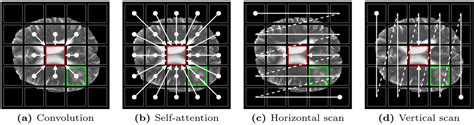 논문 리뷰 Log Vmamba Local Global Vision Mamba For Medical Image Segmentation
