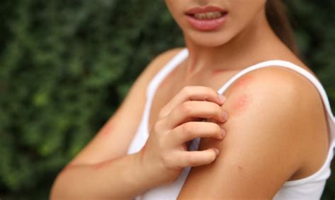 Dyshidrotic Eczema คืออะไร เกิดจากอะไร และรักษาอย่างไร Hello Khunmor