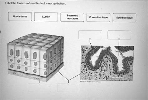 Solved Label The Features Of Stratified Columnar Epithelium Muscle Tissue Lumen Basement