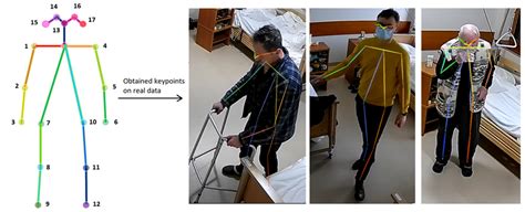 Alphapose Algorithm Illustration Keypoints On Patients Bodies In Download Scientific Diagram