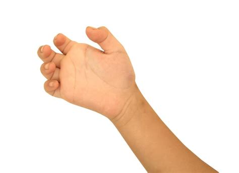 Trigger Thumb Reconstructive Plastic Surgery Canberra