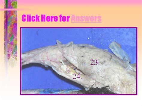 Click Here For Answers