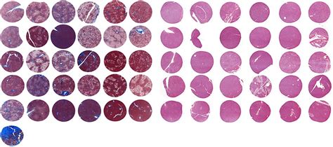 Tissue Microarrays Tma Offerings For Research Sekisui Xenotech