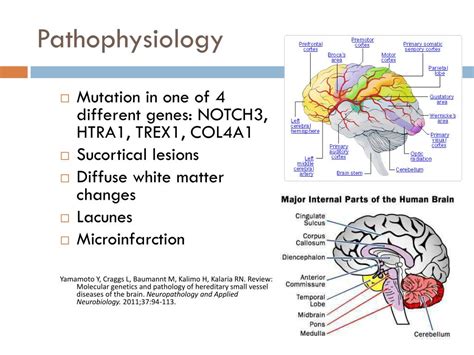 What Is A Small Vessel Disease In The Brain At Cheryl Talley Blog