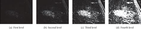 Figure 2 From Asphalt Pavement Pothole Detection And Segmentation Based On Wavelet Energy Field