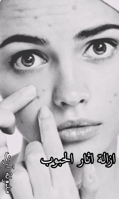 كيف ازيل الحبوب ايميجز