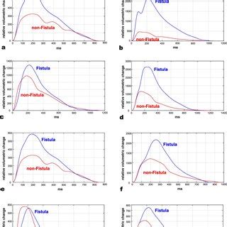 Illustration Of The Analysed Pulse Wave Parameters Visualization Of The Download Scientific