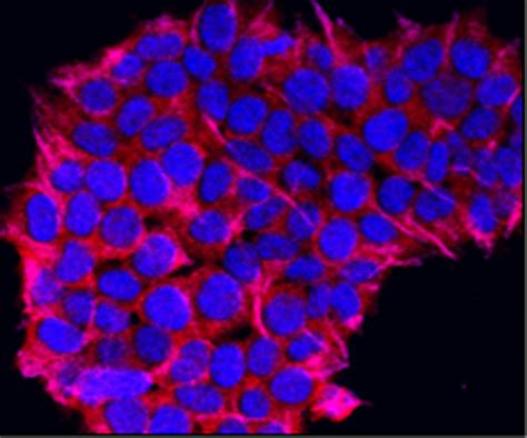 Proteínas Transmembrana En Eritrocitos