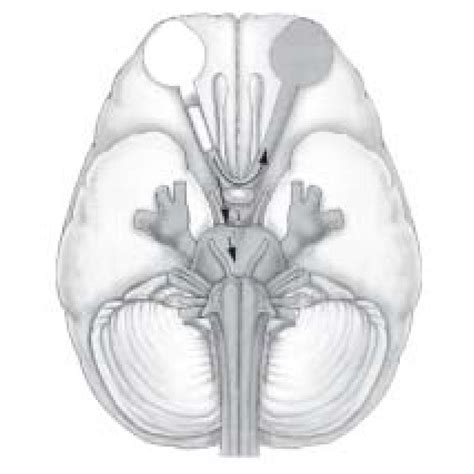 Dispersion Of The Local Anesthetic When Injected Inside The Sheath Of Download Scientific