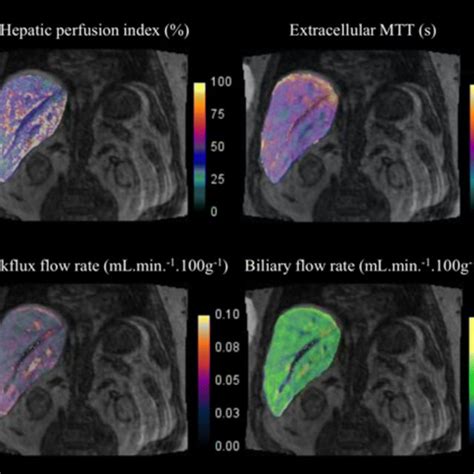 Example Of Perfusion Parametric Maps Arterial Portal And Total Download Scientific Diagram