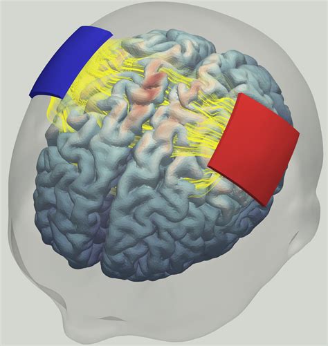 Simulation Of Tdcs Max Planck Institute For Human Cognitive And Brain Sciences