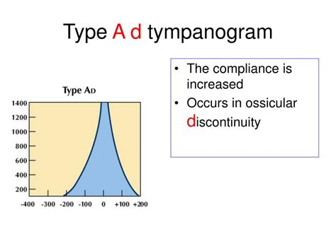 Types Of Tympanograms Lastlasopa