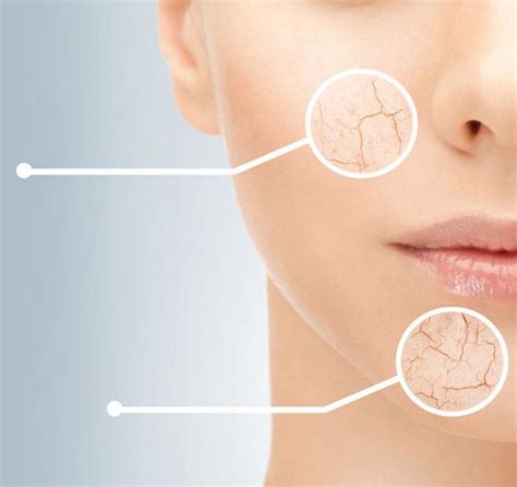 你的皮肤是哪种类型该怎么清洁与护理